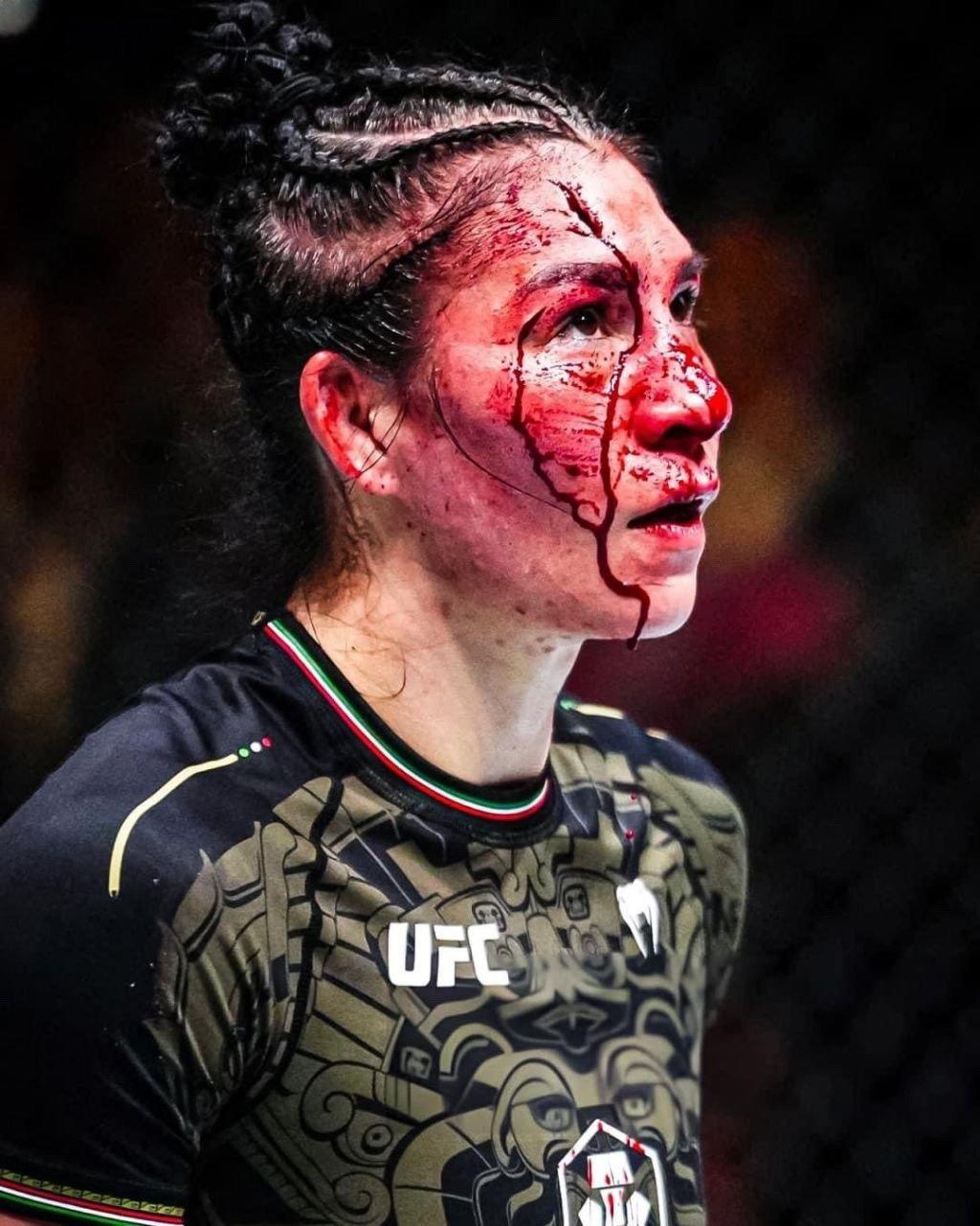 UFC: así quedó el rostro de Irene Aldana luego de sufrir distintas ...