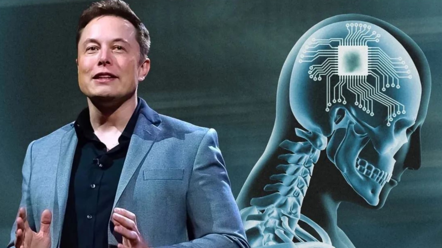 Neuralink, de Musk, inicia ensayo de viabilidad de implante cerebral y ...